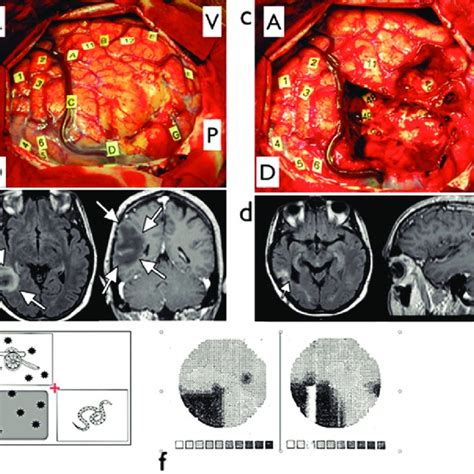 Clinical Radiological And Surgical Characteristics Of The Patients Download Table