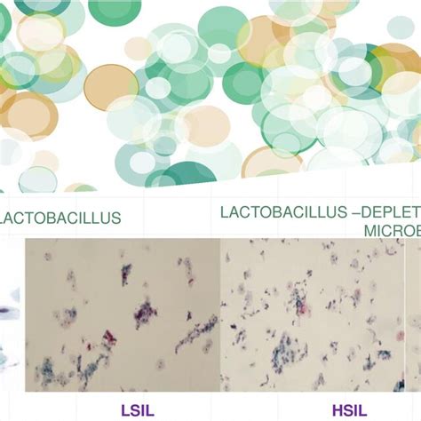 Vaginal Microbiota And Correlation With Risk Of Cervical Dysplasia