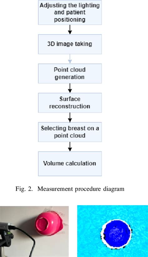 Figure 1 From Optimization Of The System For Determining The Volume Of Tissue Needed For Breast