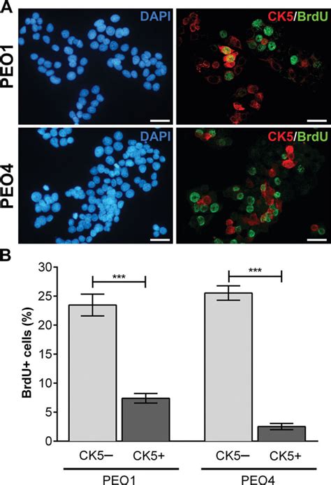 Cytokeratin 5 (CK5)+ compared to CK5− ovarian cancer cells are slower ...
