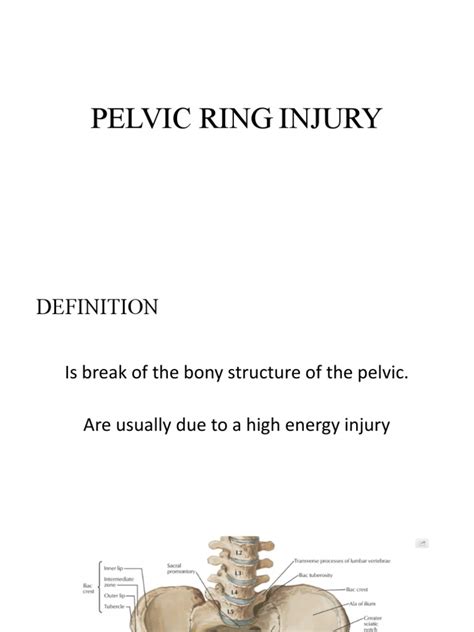 Unstable Pelvic Injury Pdf
