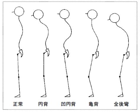 円背 ぽーる の ポジティブ Run！