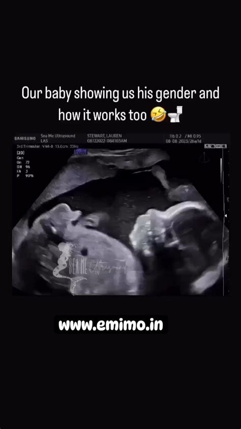 Emimo Emimoinde • Instagram Photos And Videos