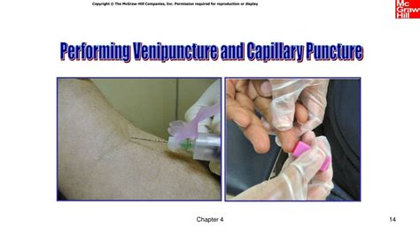 Ppt Phlebotomy Powerpoint Presentation Free Download Id1023118