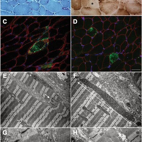 Histological Immunohistochemical And Ultrastructural Studies In