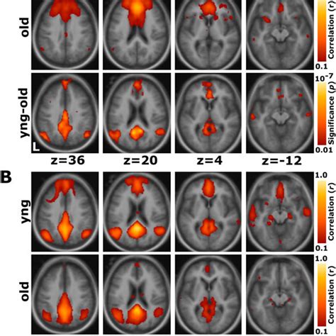 Whole Brain Exploratory Analyses Reveal Widespread Correlation Download Scientific Diagram