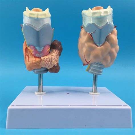 Thyroid Pathology Model Hyperthyroidism Model Human Ffsm