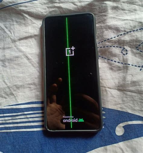Oneplus Community