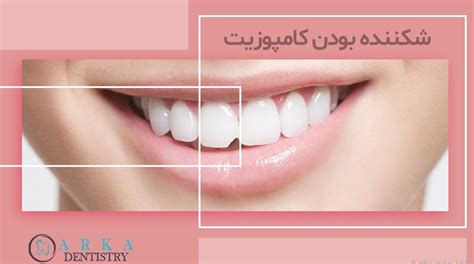 کامپوزیت دندان چیست؟؛ با مزایا و معایب آن آشنا شوید