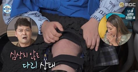 박나래 춤 추다 전방 십자 인대 파열방송 중 부상 공개