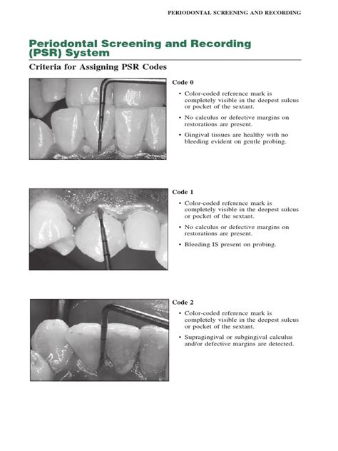 Periodontal Screening And Recording Psr System Criteria For