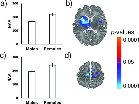 bar graphs showing sex differences in naa concentrations in the healthy