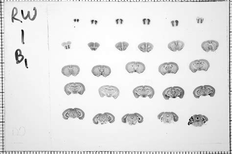 The Mouse Brain Library Search The Library