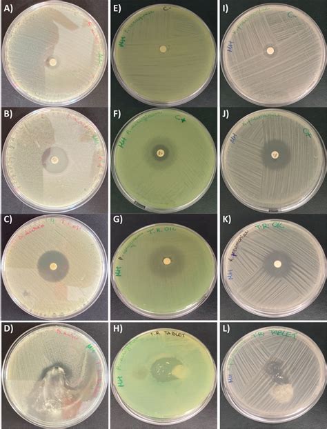 Growth Inhibition Halo Disk Diffusion Test Induced By T Vulgaris On Download Scientific