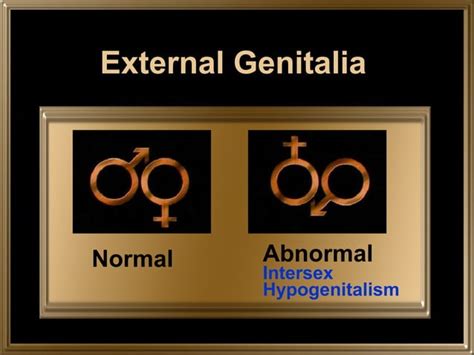 Intersex Ppt