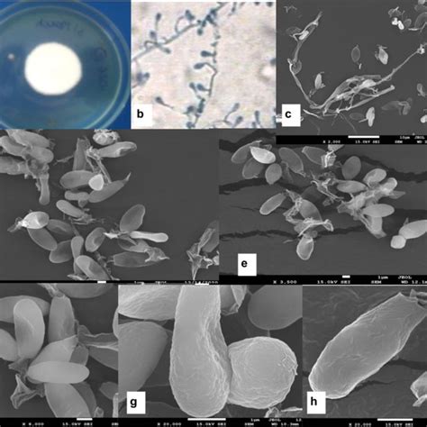 A Growth Of C Indicum On Potato Dextrose Agar B Conidia 1000x C Download Scientific