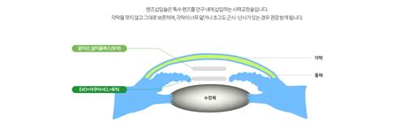 선함앤밝은봄병원 ㅣ 서면안과