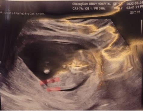 임신기록 16 임신 16주차 기록 성별 확인 성별예측방법 태몽 각도법 황실달력 정확도 슬키로운 네이버 블로그