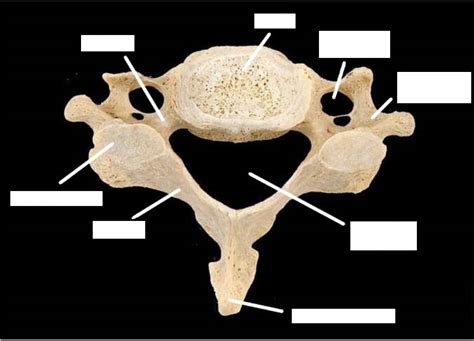 Bones Of The Vertebral Column Cervical Vertebra Diagram Quizlet