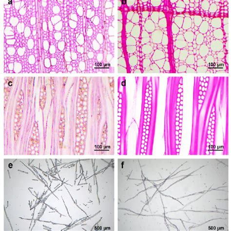 Anatomical Structure Cross Section A And B Tangential Section