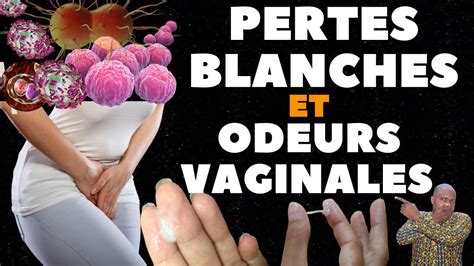 Pertes vaginales pertes blanches leucorrhées Quand faut il s