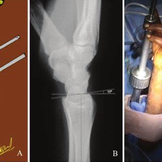 Instrument And Camera Positioning The Instruments And Camera Must Be Download Scientific