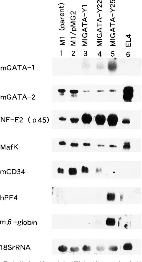 Figure 4 From Forced Gata 1 Expression In The Murine Myeloid Cell Line
