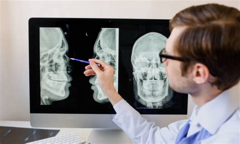 Why Are Ct Scans Necessary For Nasal Bone Fractures