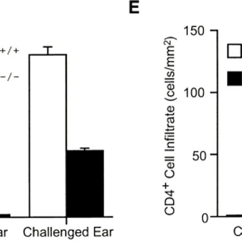 Histological Analysis Of Contact Hypersensitivity Response Ac