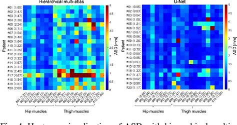Automated Muscle Segmentation From Clinical Ct Using Bayesian U Net For