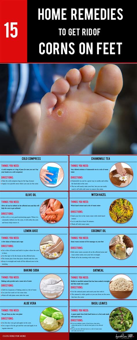 How To Fix Corns And Calluses Corns And Calluses Causes Prevention