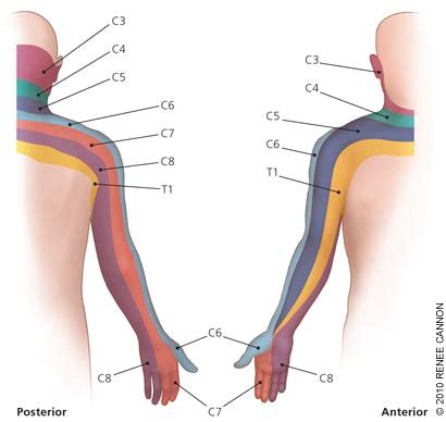 C7 C8 Radiculopathy Radiculopathie Quest Ce Que Cest Et Comment La