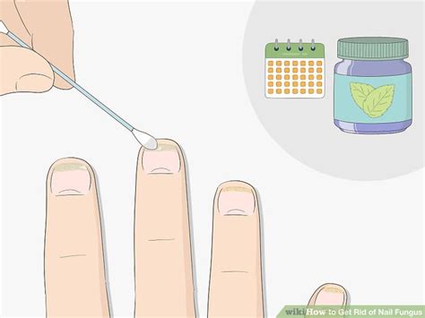 3 Ways To Get Rid Of Nail Fungus Wikihow