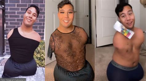Impresionante Joven Sin Manos Ni Piernas Se Viraliza En TikTok Con