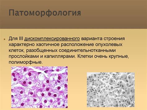 Феохромоцитома Причины феохромоцитомы презентация онлайн
