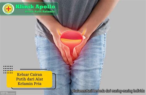 Cek Penyebab Keluar Cairan Putih Dari Alat Kelamin Pria Klinik Apollo Jakarta