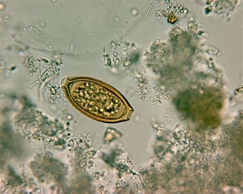 Trichuris Trichiura Parasite Diagnosis