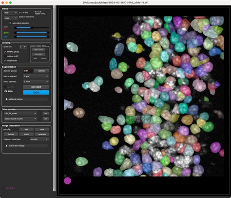 RunCellPose Plugin Has Different Results From Standalone CellPose