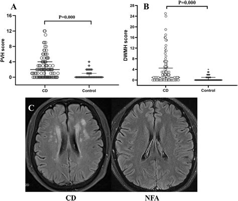 A And B Mri Findings In Nfa Subjects And Cd Patients For Pvh