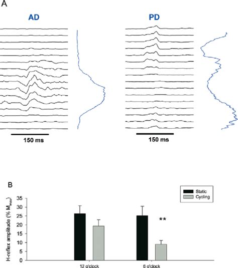Phase Dependence Of Reflexes During Arm Cycling A Cutaneous Reflexes Download Scientific