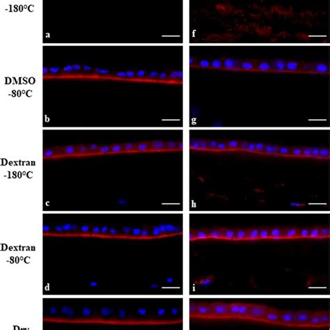 Immunohistological Staining Of Basement Membrane Components Download Scientific Diagram