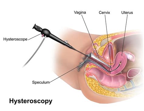 Hysteroscopy And Colposcopy Pranayam Cardiac And Women S Clinic