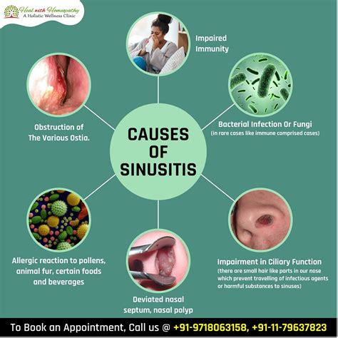Causes Of Sinusitis Dr Geeta Rani Arora Medium