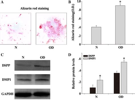 The Mineralization And Proliferation Abilities Of Dpscs During