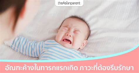 อัณฑะค้าง อัณฑะคาช่องท้อง ภาวะผิดปกติในทารกแรกเกิด ควรรักษาก่อน 1 ขวบ