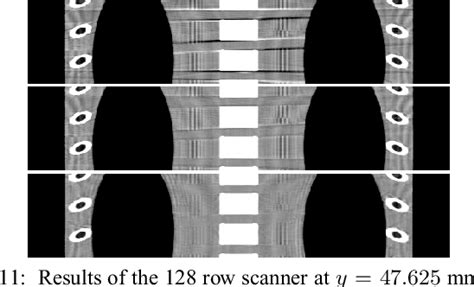 Figure 11 From Evaluation Of Helical Cone Beam Ct Reconstruction
