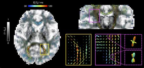 Computing And Visualising Intra‐voxel Orientation‐specific Relaxationdiffusion Features In The