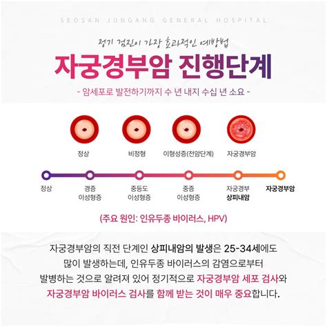 자궁경부암 검진 바이러스검사가 중요한 이유 서산중앙병원