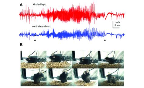 Representative Eeg Discharges And Corresponding Motor Seizure Eeg