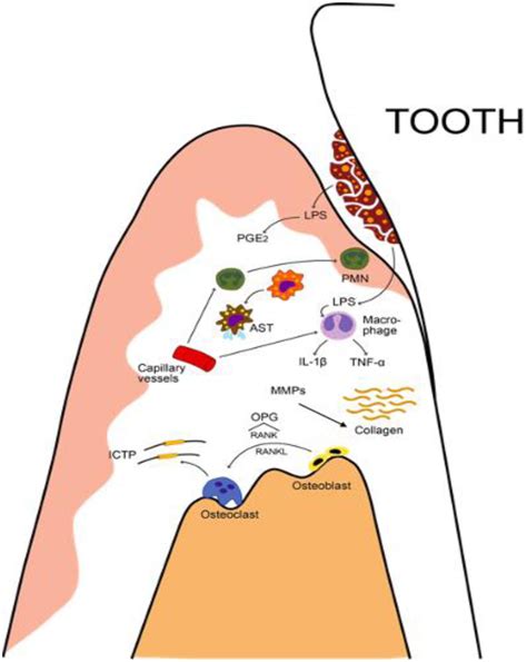 A Mini Review On The Associations Of Matrix Metalloproteinases MMPs With